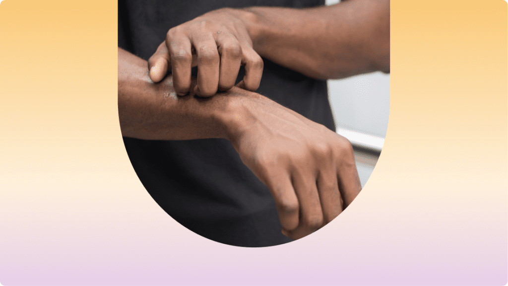 Understanding Anxiety Itching: Why It Happens and How to Manage It