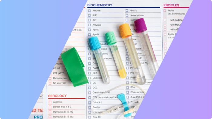 I have an intense fear of blood. Could it be OCD? | NOCD